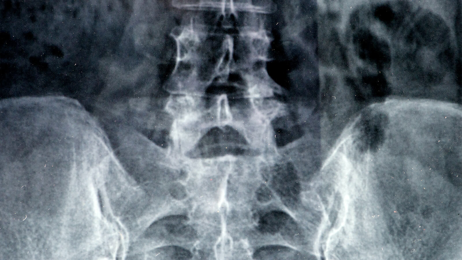 Röntgendiagnostik für Rheuma-Patienten / Rheuma-Praxis Bonn